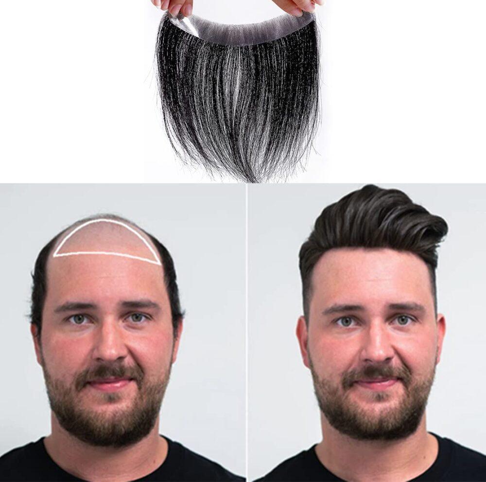 Hair Extensions For Men: Types, How To Choose And More